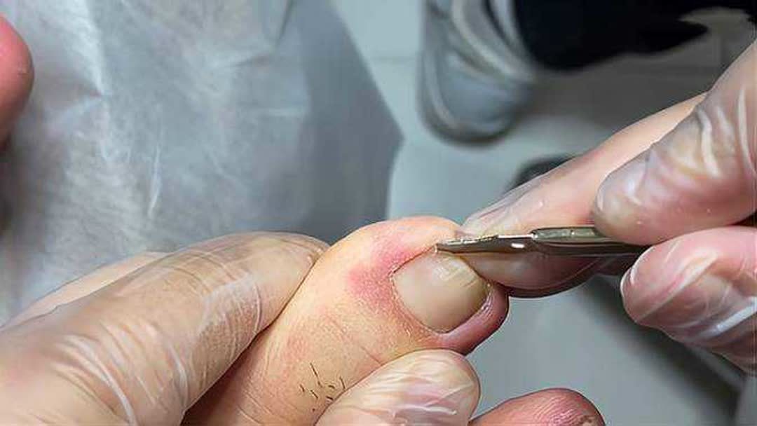 超解压的修脚近距离过程