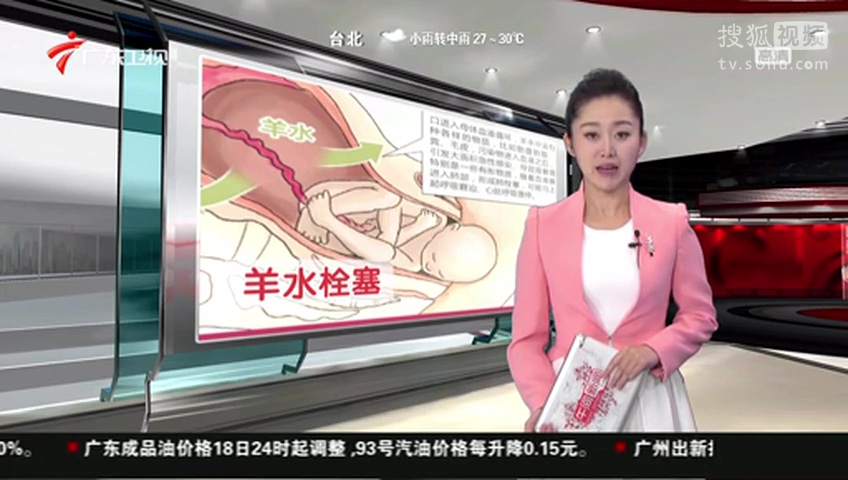 新闻链接:什么是羊水栓塞?
