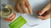 烁蒂医疗牙科树脂补牙修复成型片及夹子操作方法