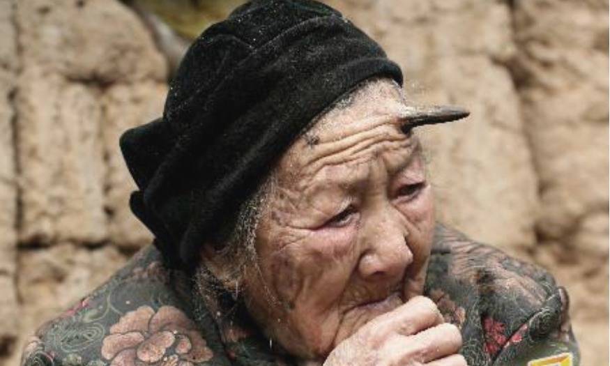 老奶奶头上的瘊子变成了"角",越长越大,医生表示没必要手术