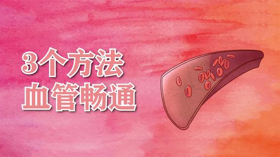 血管堵了怎么办?3个"自救"方法,让血管恢复畅通
