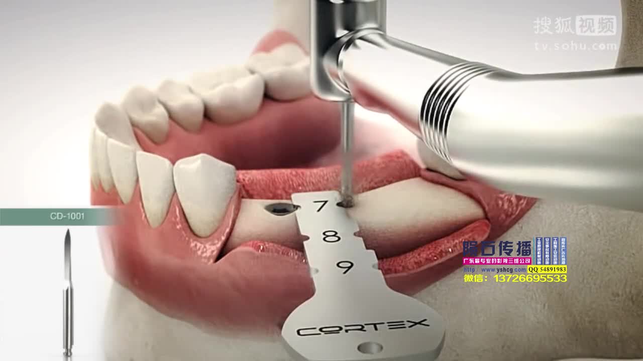 听说这是一部业内领先的医疗三维动画宣传片