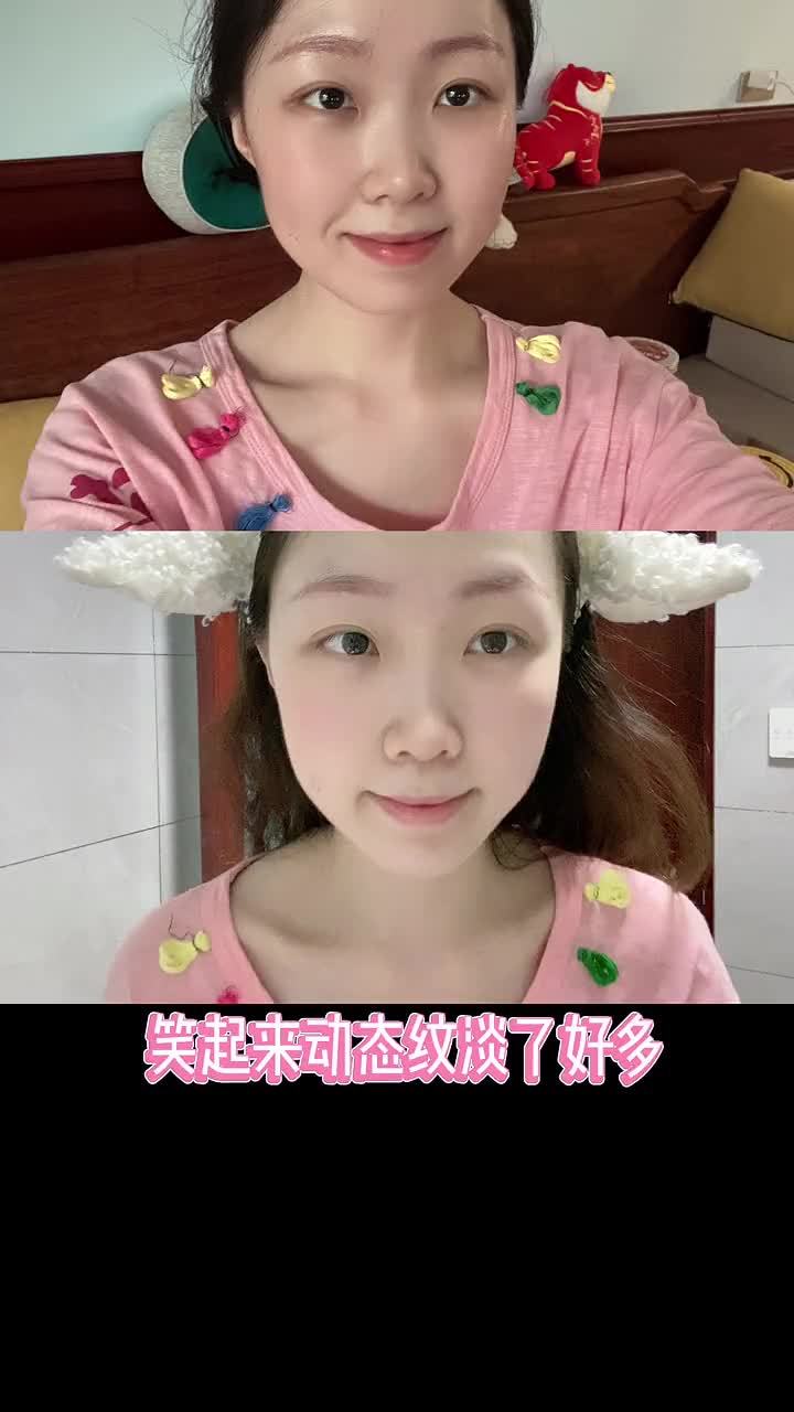 一周打卡实录!Amiro美容仪真的好用!amiro美容仪美容仪好物推荐