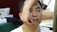 肺肾引起下肢水肿怎么办?中医舒卿针灸水针金针调理男科,金二针赶紧...