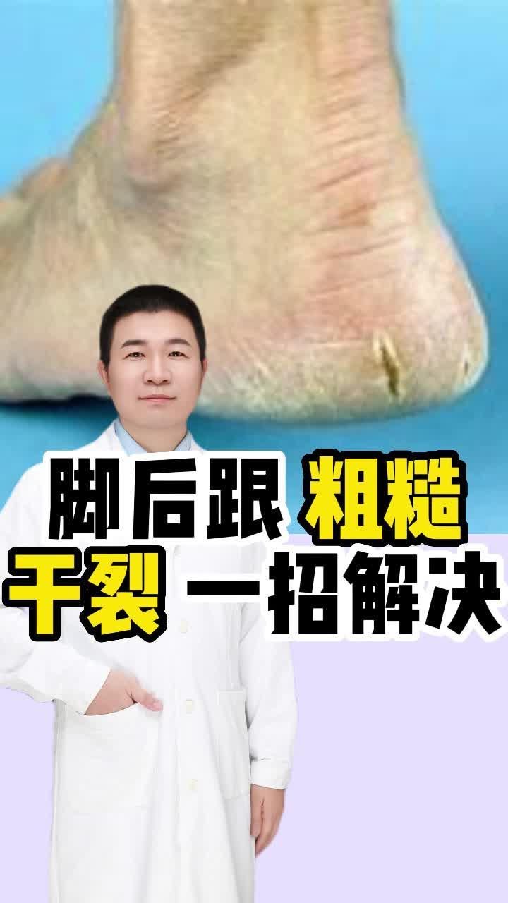 还在苦恼脚后跟其硬皮粗糙、干裂?看看这个视频#医学科普 #角化型...