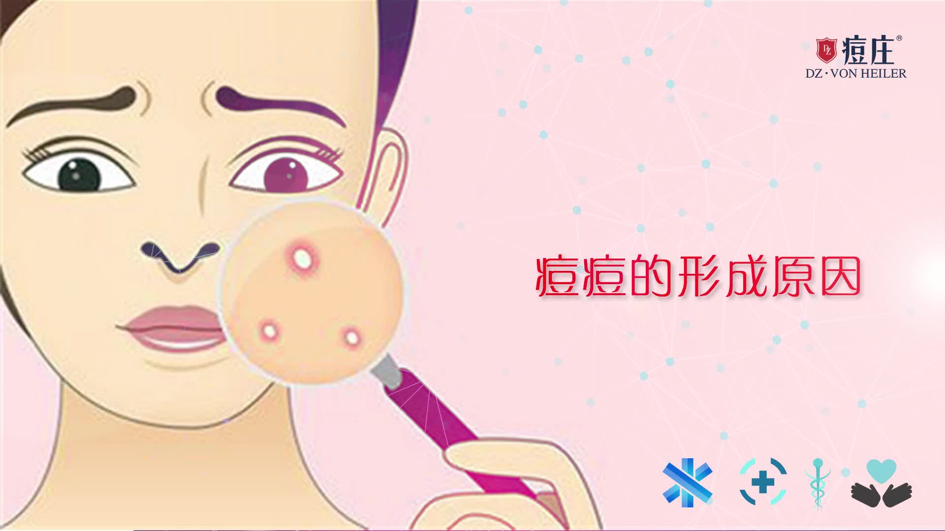 痘庄动画讲解痘痘形成的成因!