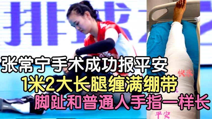 张常宁手术成功报平安 1米2大长腿缠满绷带 脚趾和普通人手指一样