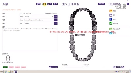 牙科CAD软件ExoCad DentalDB CAM&CAD 2011-2015版演示教程