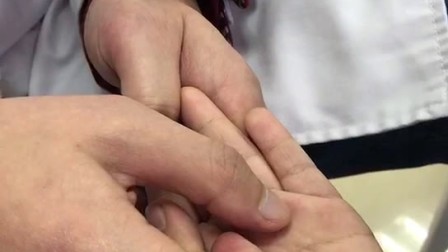 “小儿推拿王”王文圣医师——正规医疗清肺经手法操作