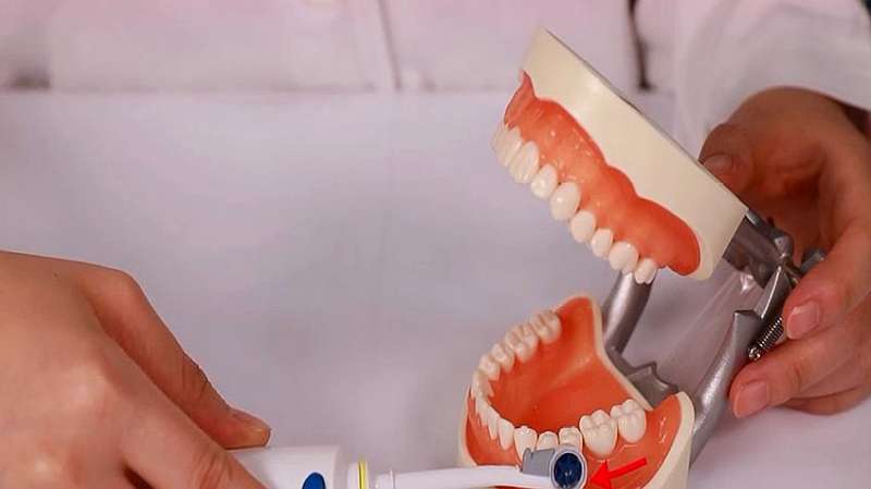 牙龈炎患者口腔护理冲牙器使用视频