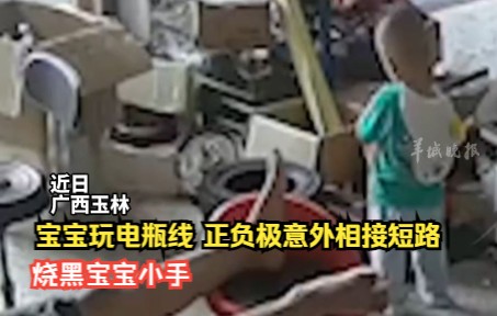 宝宝玩电瓶线 正负极意外相接短路 烧黑宝宝小手