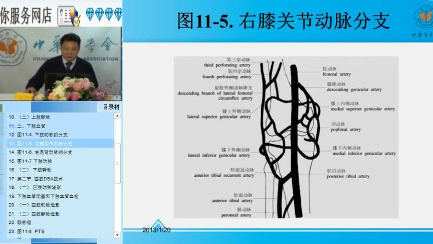 【DSA技师】第11章-四肢血管DSA技术