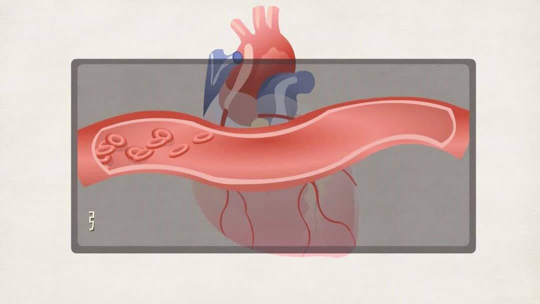 动脉硬化后还做这件事等于害自己 身边如果有这样人最好别让做了
