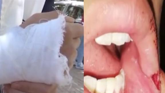 初三学生被老师打骨折,警棍防暴钢叉按草里打!学校:监控不公开