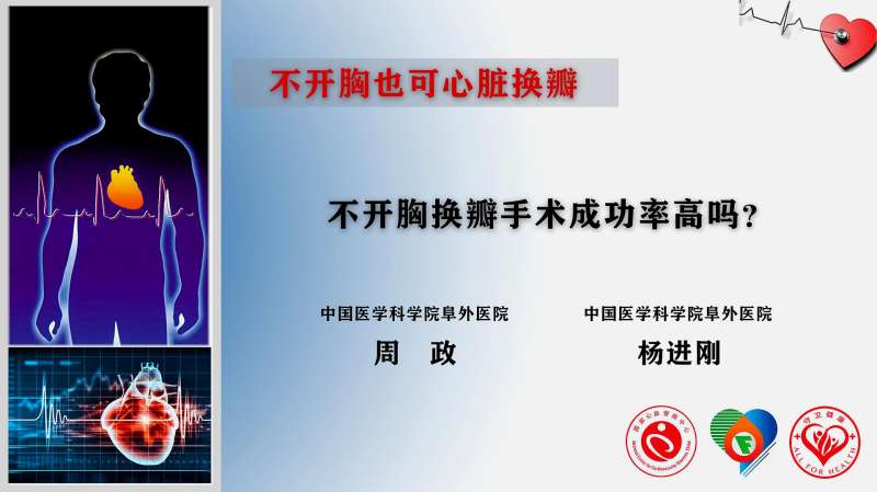 不开胸换瓣手术成功率高吗?