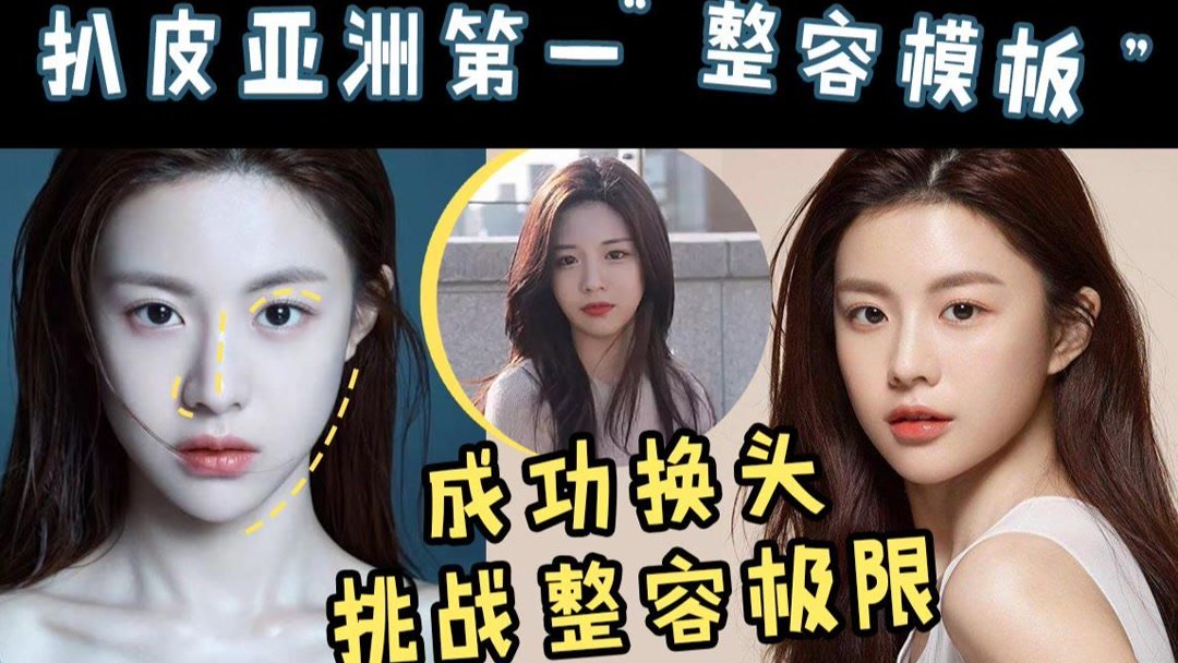 整容医生都赞叹的神仙颜值!网红脸如何逆袭变成高级脸?变美分析