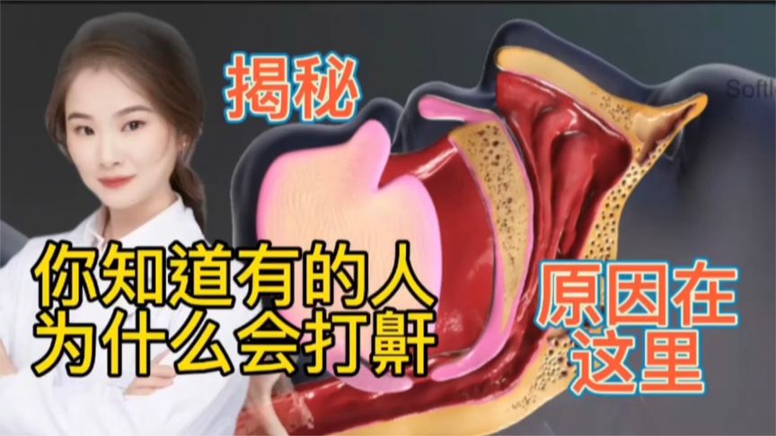 医学揭秘 有的人为什么会打呼噜 日常如何预防 看完你就知道了