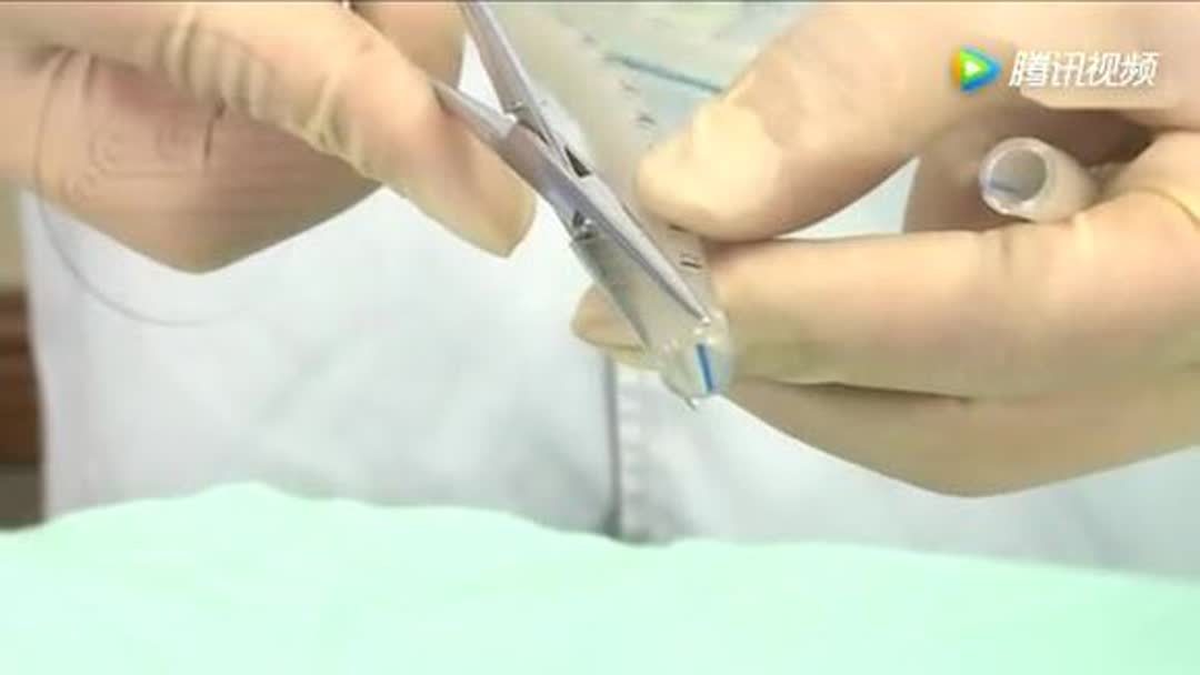 胸腔闭式引流术