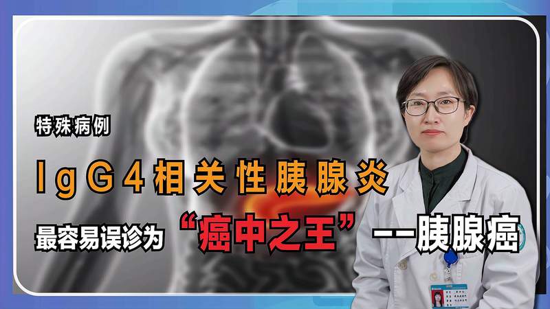 特殊病例:最容易误诊为“胰腺癌”的疾病,一旦发现即晚期!