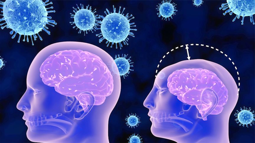 研究发现:新冠病毒入侵大脑,挟持脑细胞繁殖逼邻近细胞窒息死亡