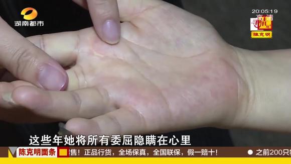 用皮带打,被针扎,还被烟头烫?女子细数父亲对她的暴力行为