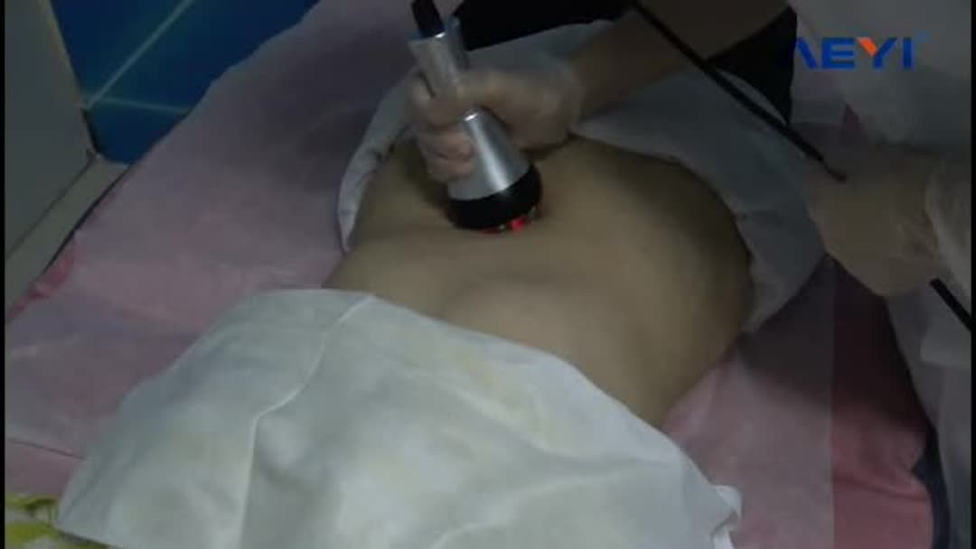 艾颜佳40K爆脂仪操作视频