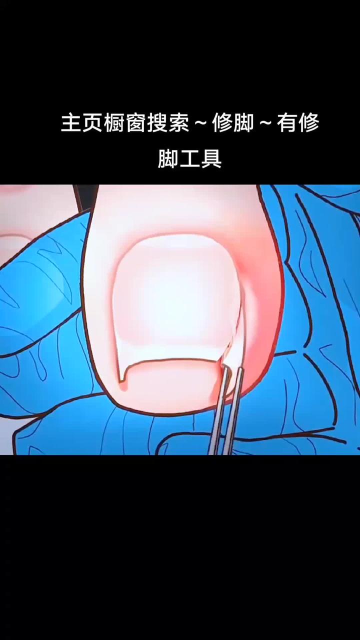 #强迫症 #强迫症治愈系 #修脚#修脚工具#修脚刀