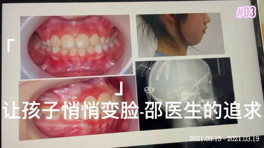 让孩子在生长过程中慢慢变美