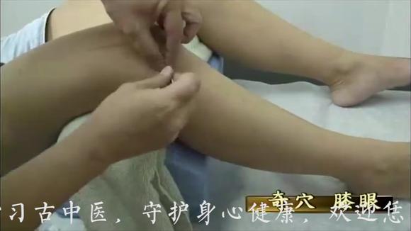 中医针灸:奇穴 膝眼