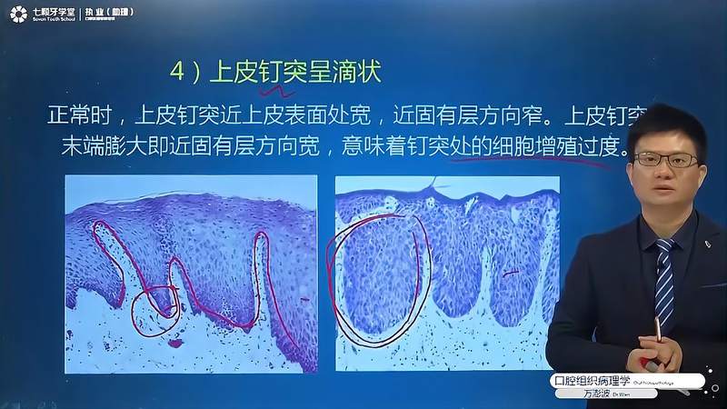 口腔执业/助理:上皮钉突呈滴状考点精讲 七颗牙学堂考点精讲
