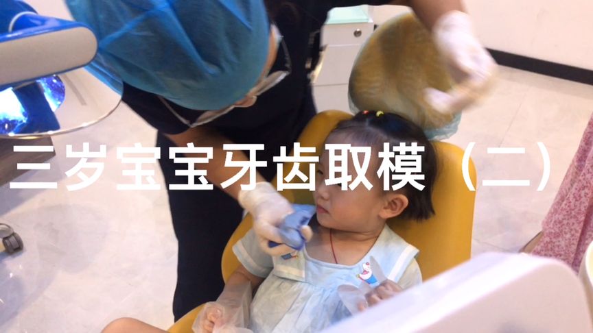 三岁宝宝牙齿取模二#儿童牙科
