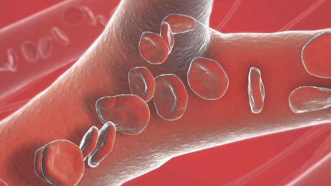 血管不好,牢记1种食物,每天吃,血管不堵,血流通畅,健康长寿