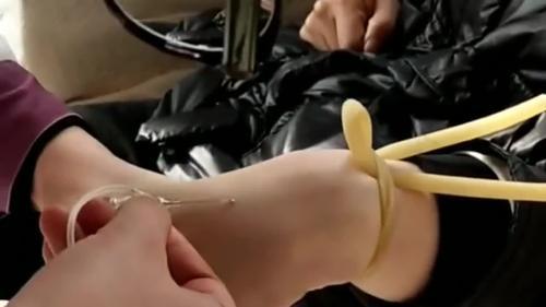 静脉输液单手留置针,护士一针就能扎这么准,病人能少受不少罪呢