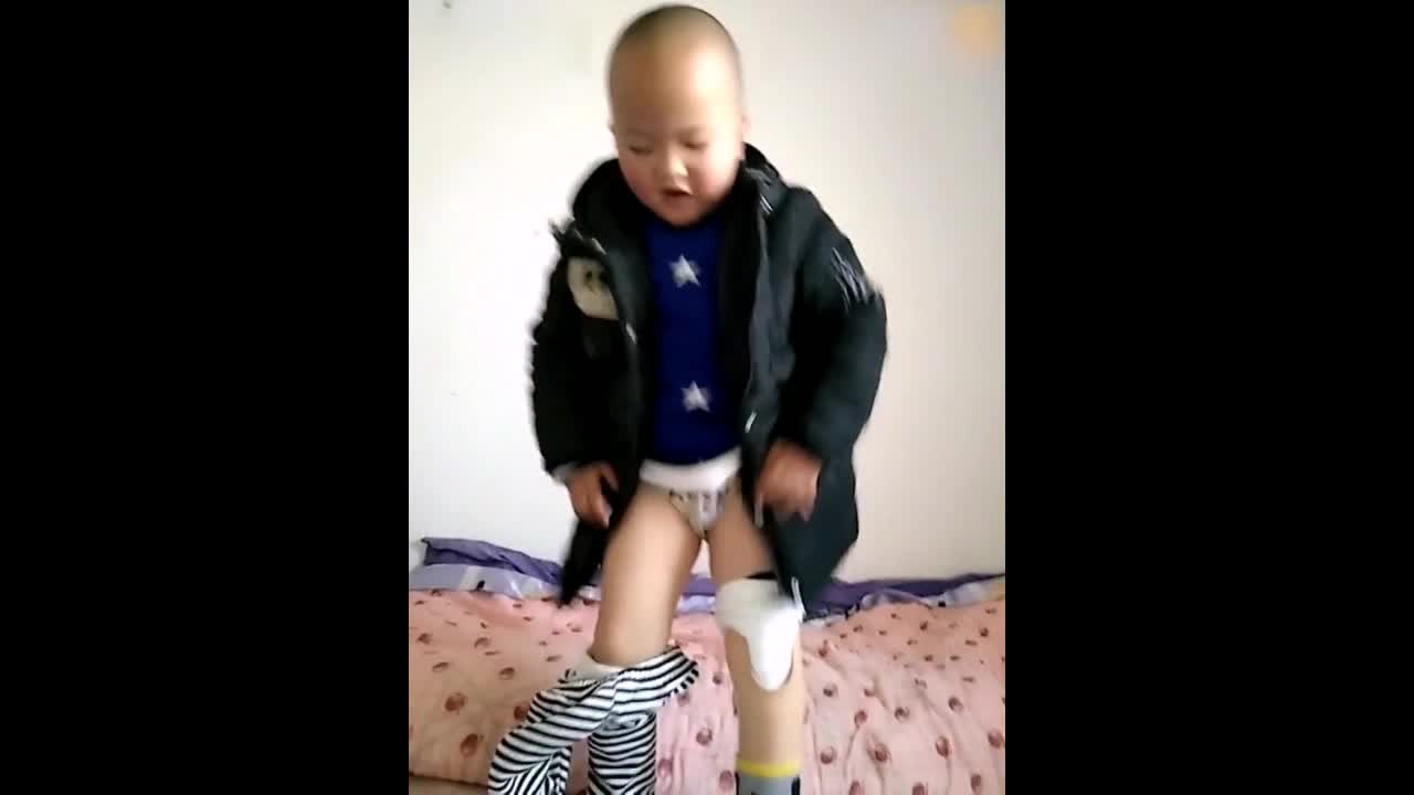 农村残疾宝宝小腿截肢,给自己穿假肢让人心疼,自己还很乐观!