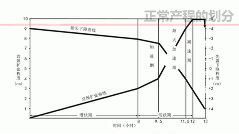 医学生如何绘制产程图