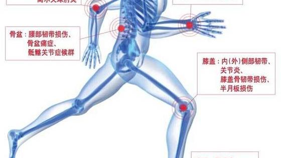 富血小板血浆(PRP):肌骨疾病的新选择