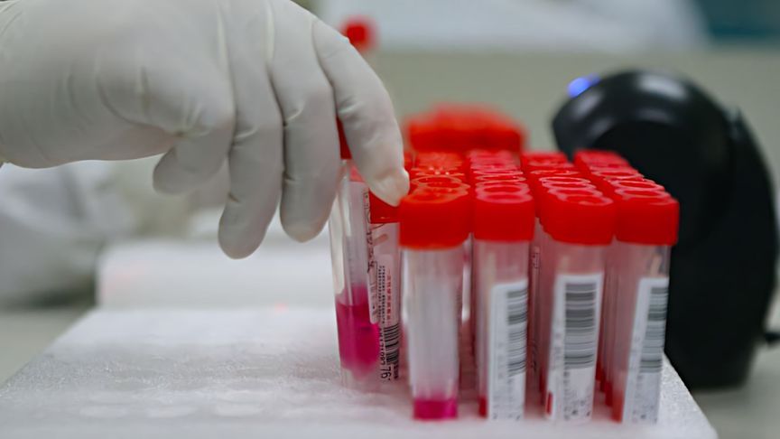 新冠感染"乙类乙管"今天开始,这些变化与你息息相关