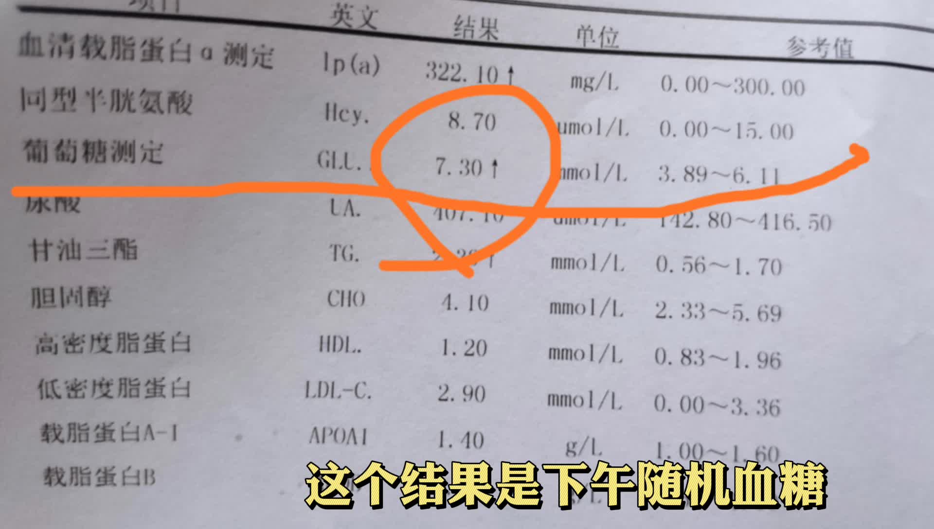 第606集:血糖仪准确性大对比,生化血对标糖护士spug、罗氏逸智