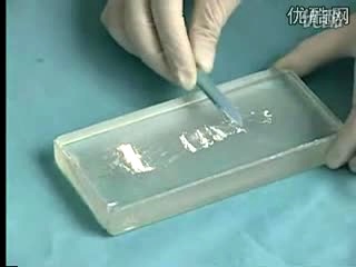 口腔医学视频水门汀