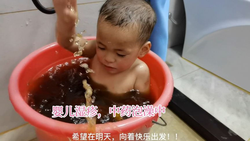 婴儿湿疹到处求医未果,还是中医博大精深,中药泡澡效果明显