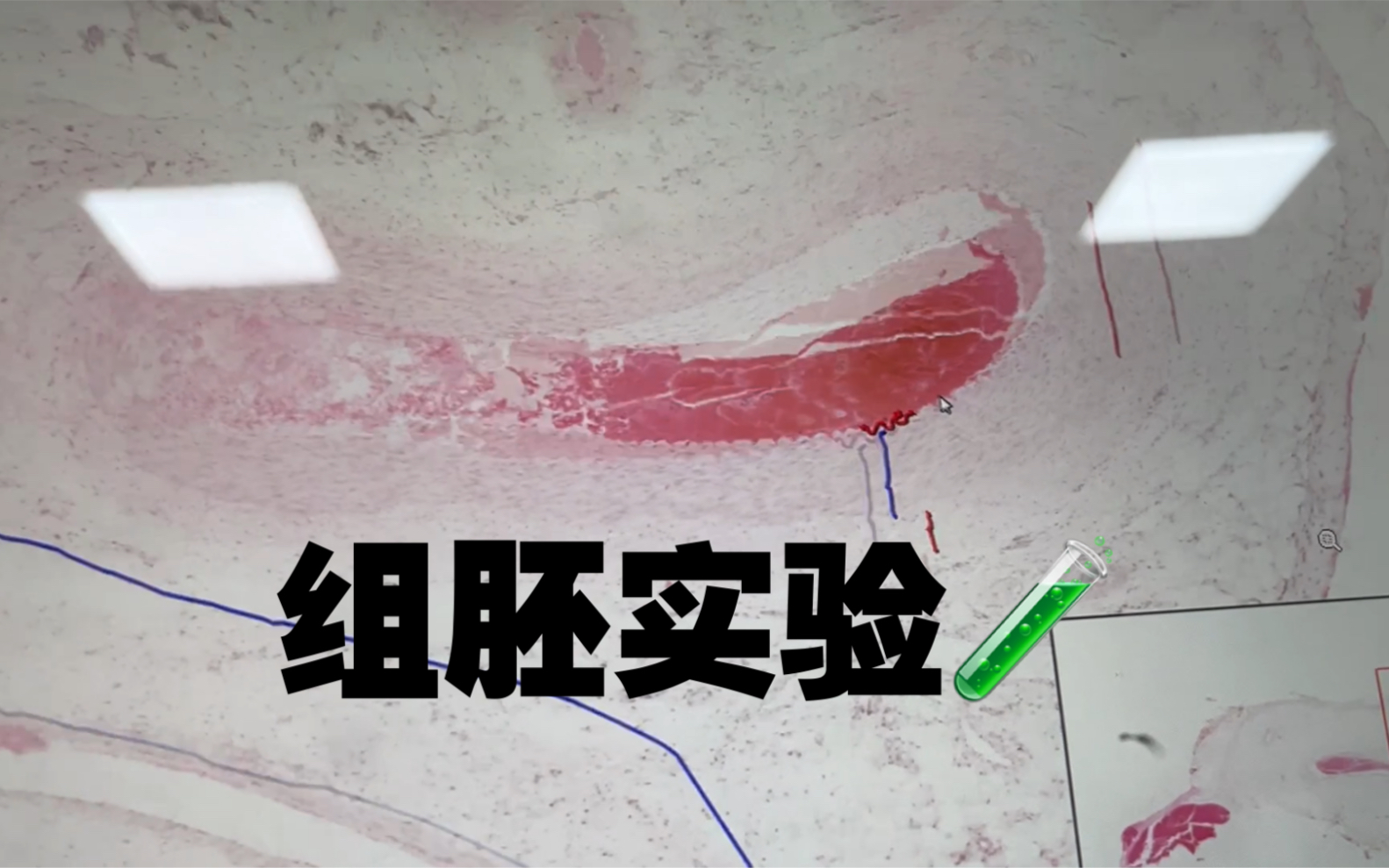 组织学与胚胎学实验讲解(自存)