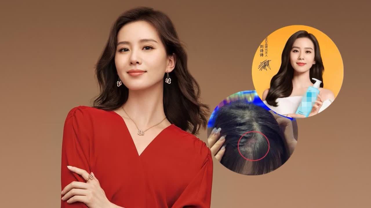 继马伊琍翻车后!刘诗诗代言微商洗发水被曝出事 消费者用后斑秃