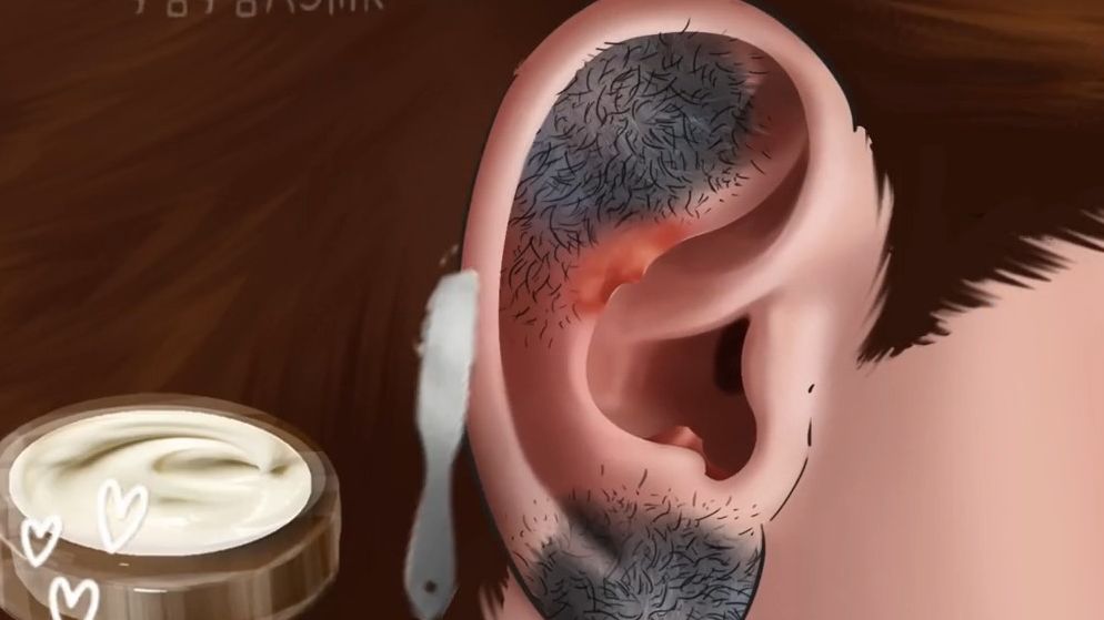 解压动画:我滴妈!这耳朵长毛了!