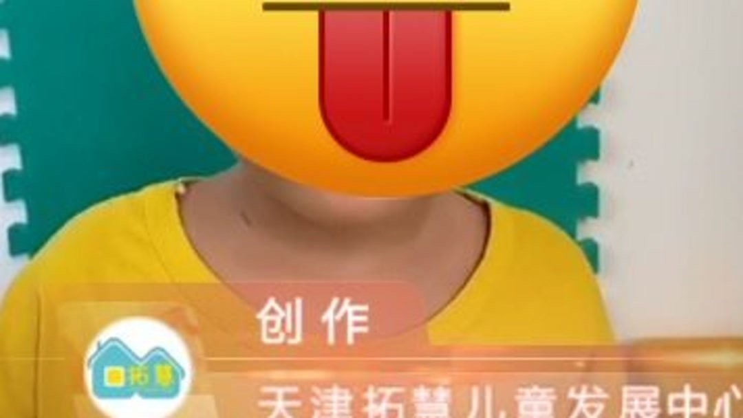 天津自闭症儿童康复机构 语言发育迟缓宝宝自我介绍