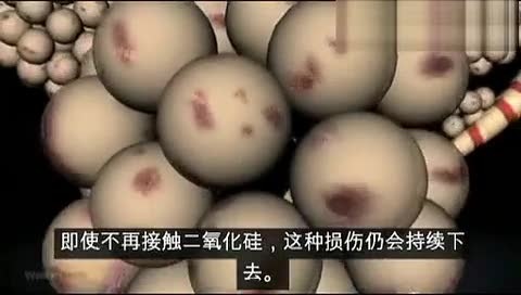 二氧化硅的危害 高清