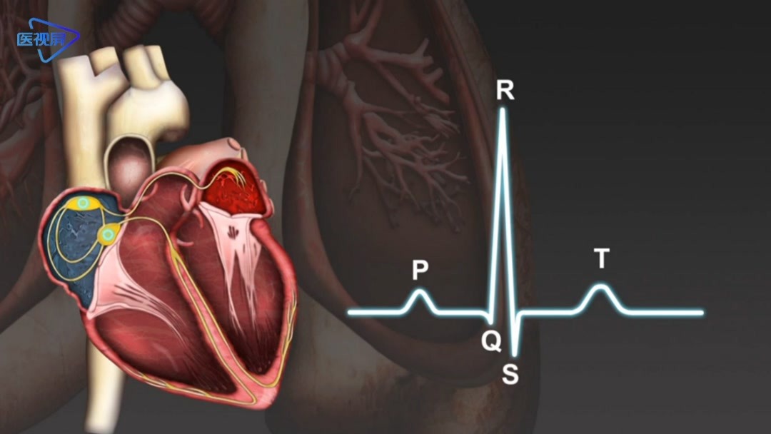 动画演示:心电图的原理