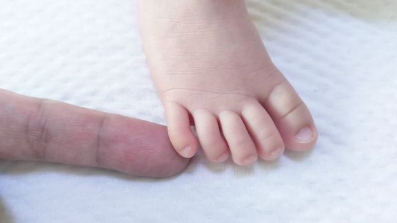 宝宝长湿疹痒得难受,教你不用涂药膏,轻轻松松防湿疹的方法!