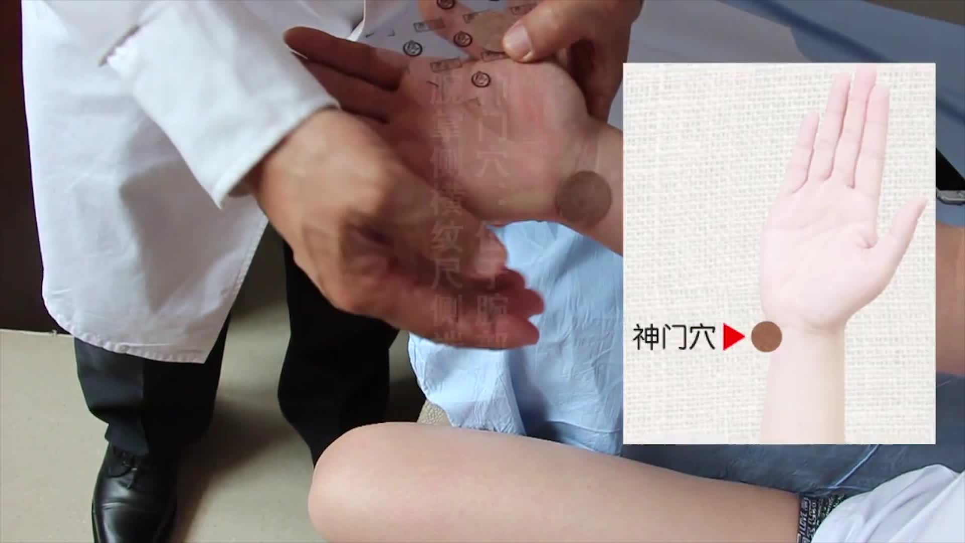 贴针灸I谷世喆带你认穴位神门穴