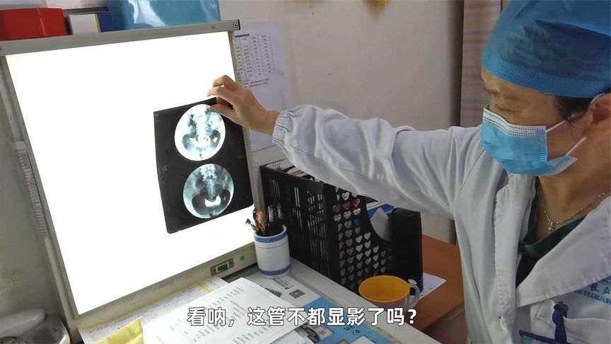 输卵管阻塞手术后,如何确认已经疏通了?疏通后怎样才能快怀孕?