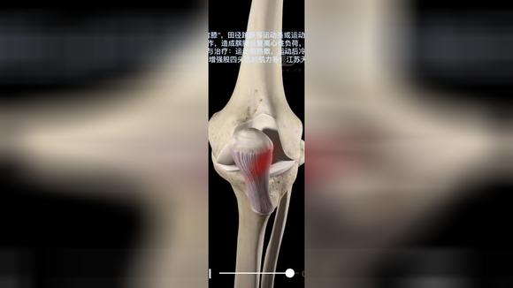 「解剖学动画」膑腱炎